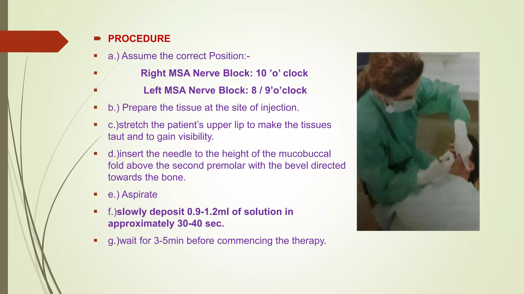 Superior Alveolar Nerve Block.pptx