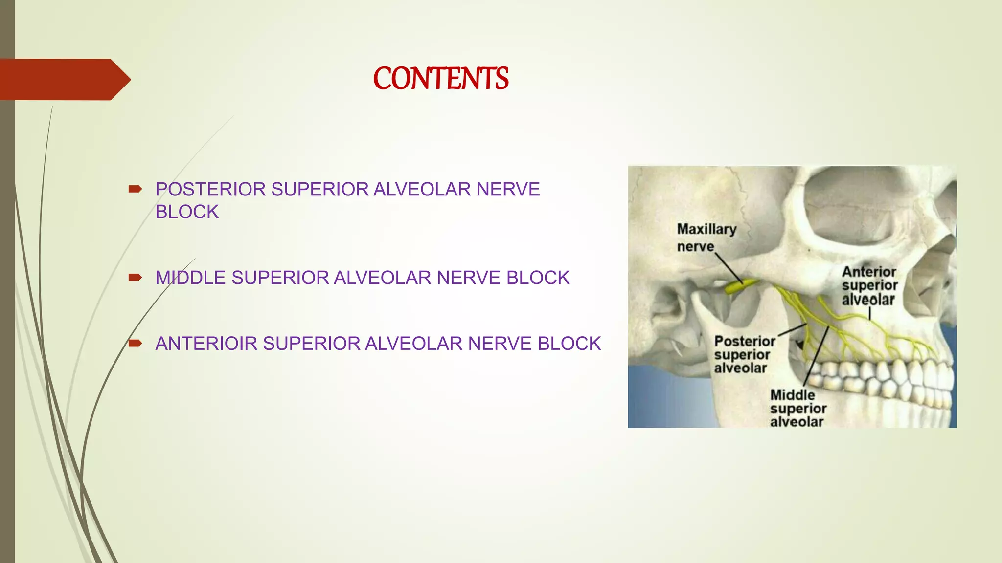 Superior Alveolar Nerve Block.pptx