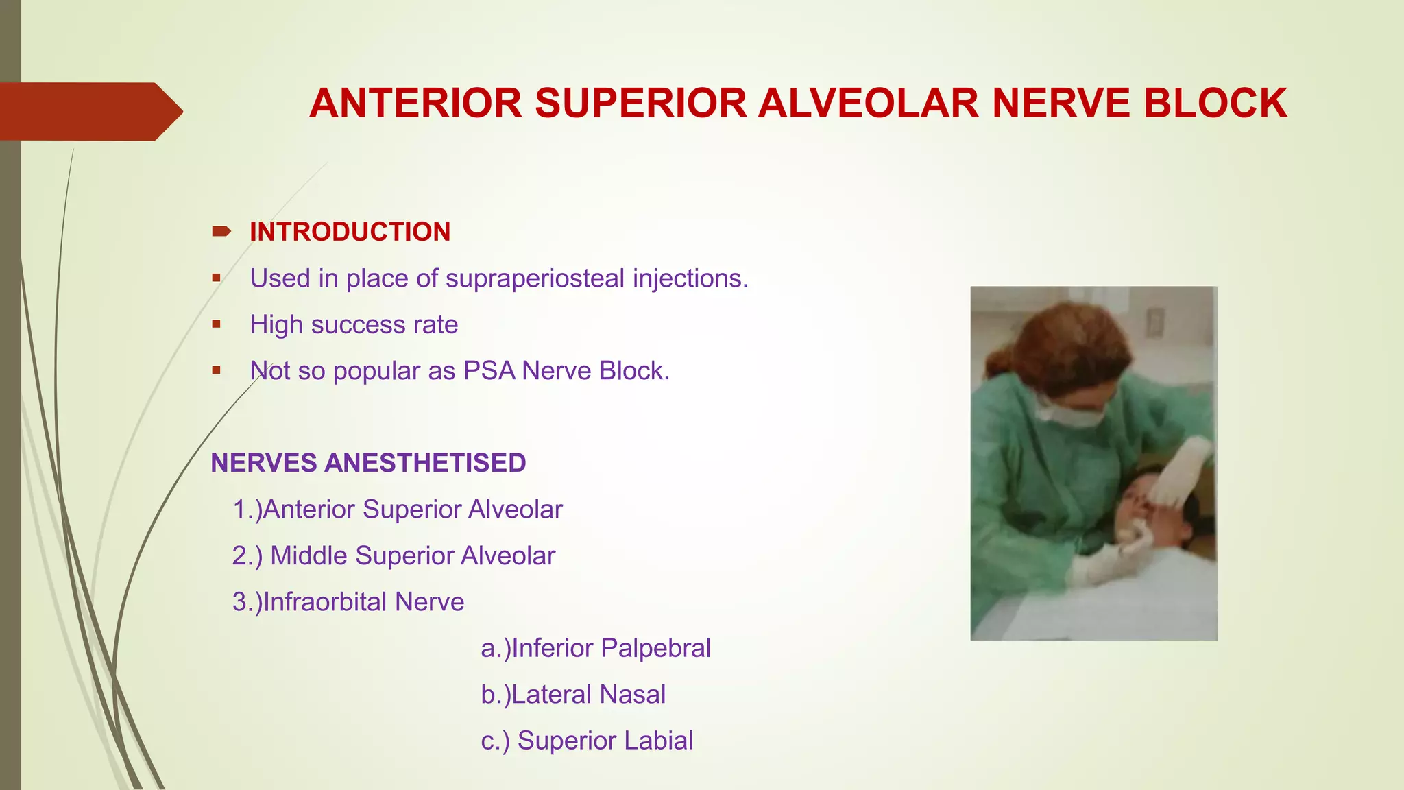 Superior Alveolar Nerve Block.pptx