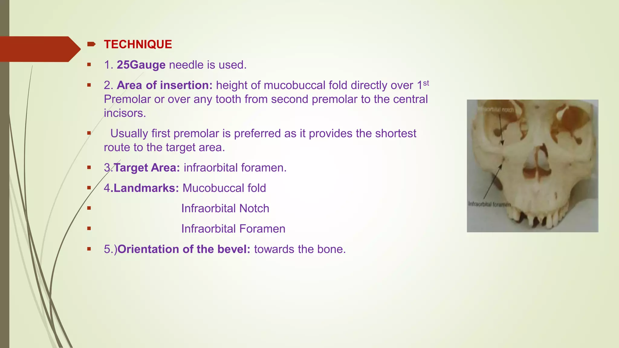 Superior Alveolar Nerve Block.pptx