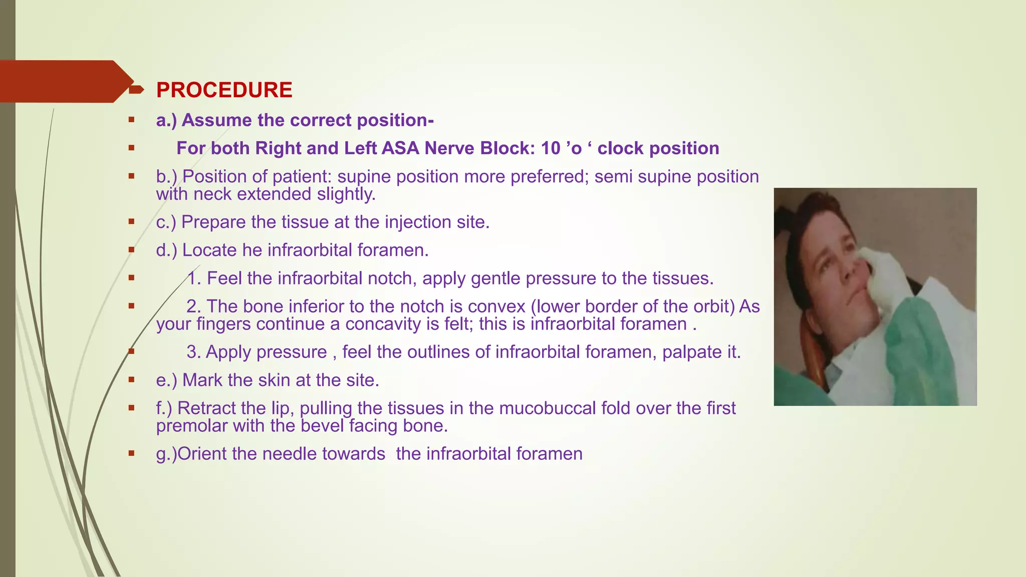 Superior Alveolar Nerve Block.pptx