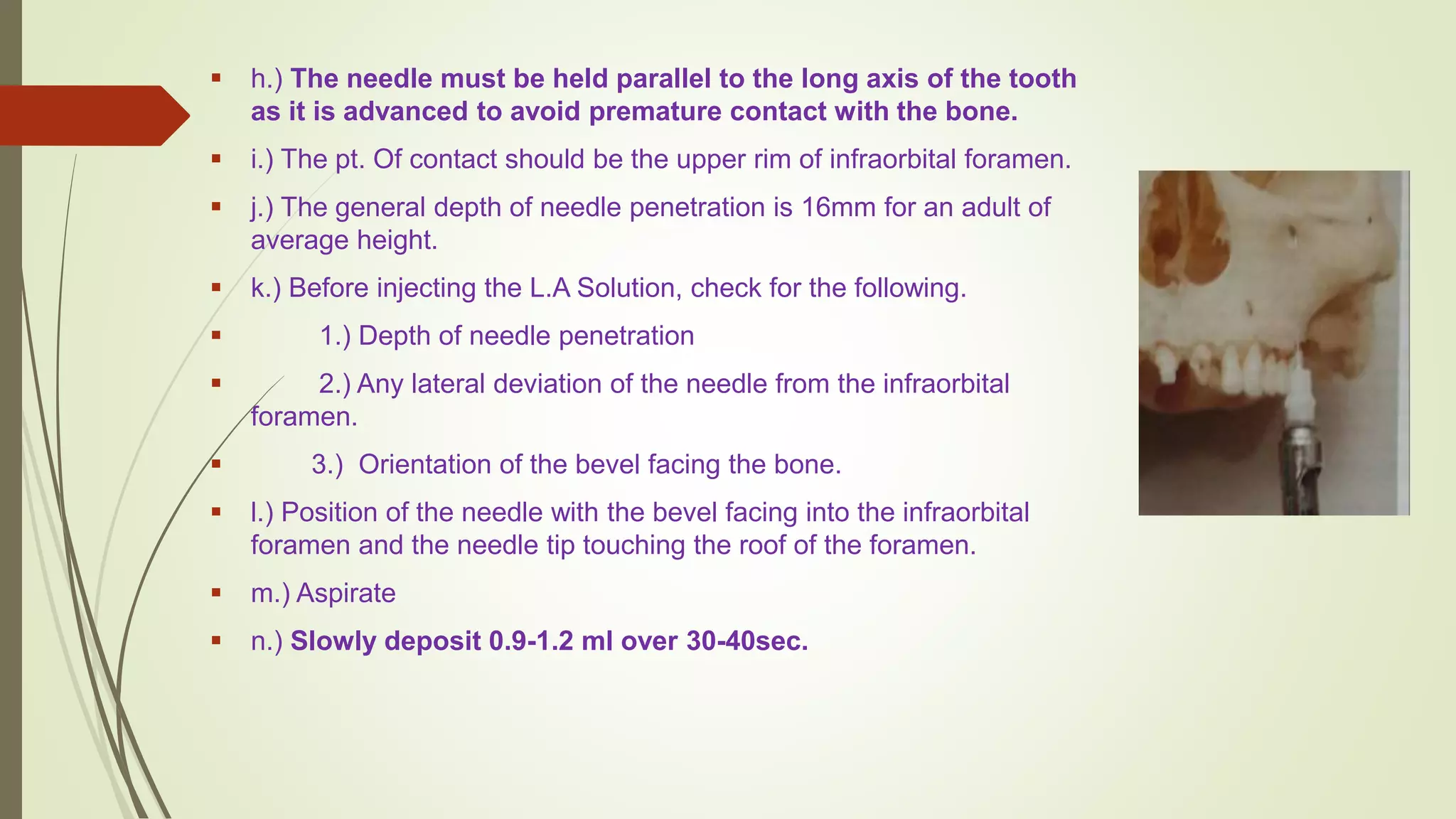 Superior Alveolar Nerve Block.pptx