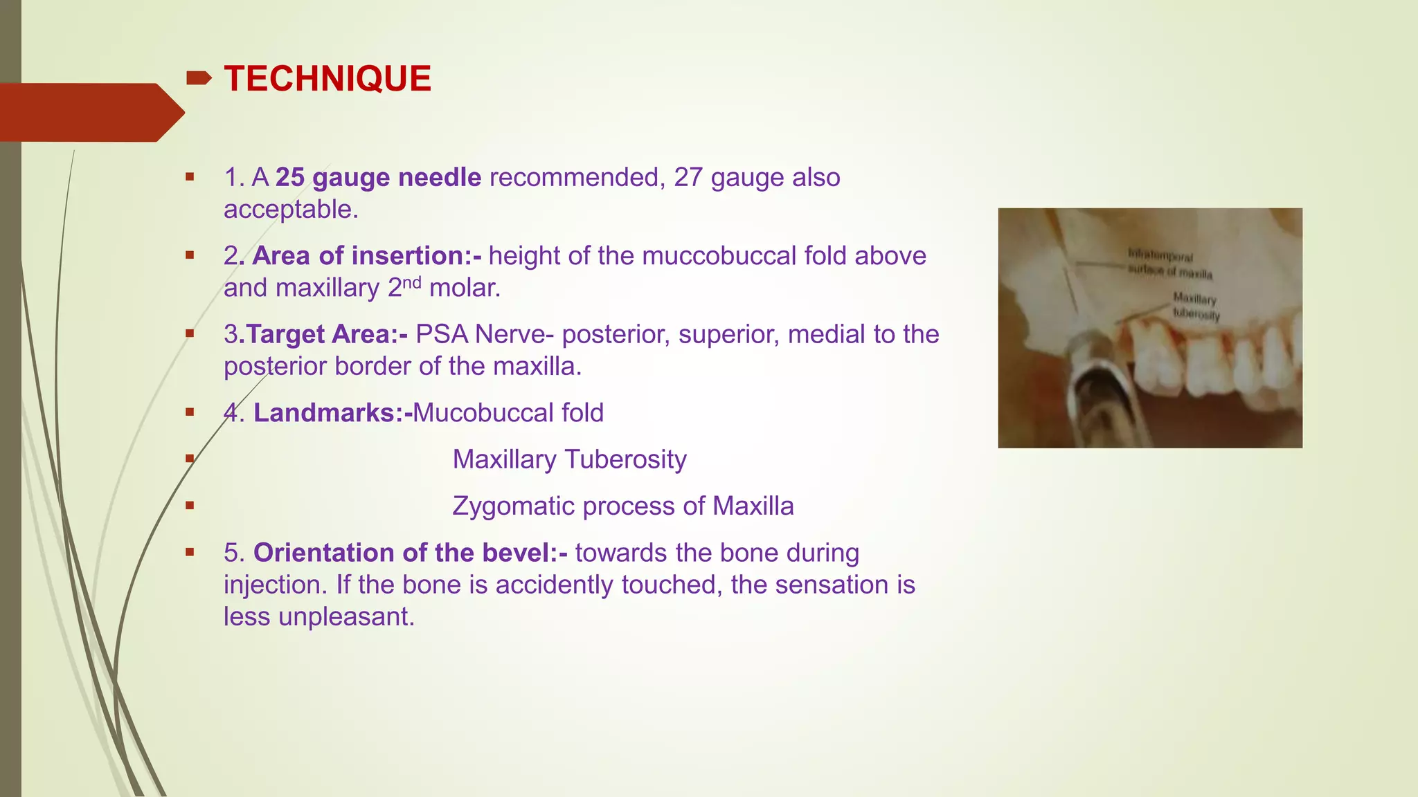 Superior Alveolar Nerve Block.pptx