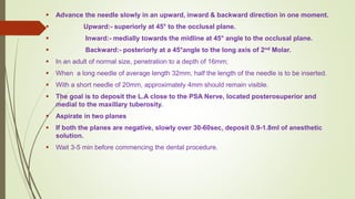 Superior Alveolar Nerve Block.pptx