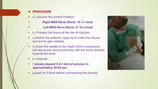 Superior Alveolar Nerve Block.pptx