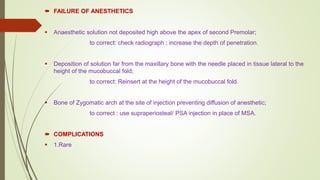 Superior Alveolar Nerve Block.pptx