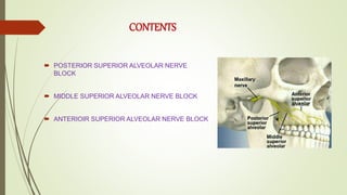 Anterior Superior Alveolar Nerve Block