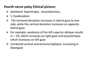 Superior oblique palsy | PPT