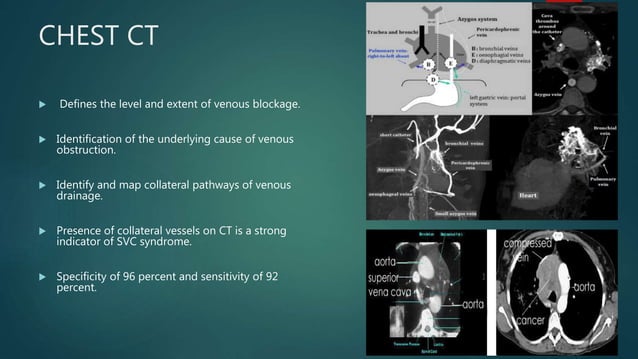 Superior vena cava syndrome | PPTX | Heart and Cardiovascular Diseases ...