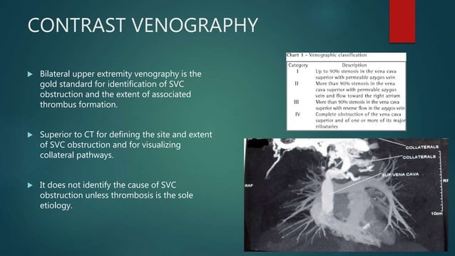Superior vena cava syndrome | PPTX | Heart and Cardiovascular Diseases ...
