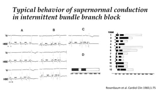 A thorough review of supernormal conduction.pptx | Free Download