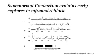 A thorough review of supernormal conduction.pptx