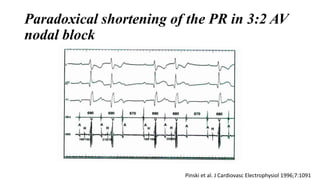 A thorough review of supernormal conduction.pptx