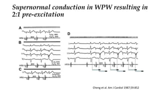 A thorough review of supernormal conduction.pptx