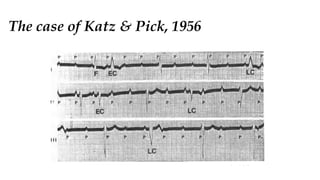 A thorough review of supernormal conduction.pptx | Free Download