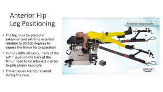 Super path hip replacement | PPTX