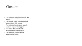 Super path hip replacement | PPTX