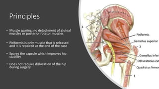 Super path hip replacement | PPTX