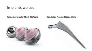 Super path hip replacement | PPTX