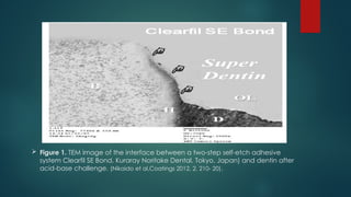 Super Tooth in Dentistry (Adhesion in Dentistry).ppt