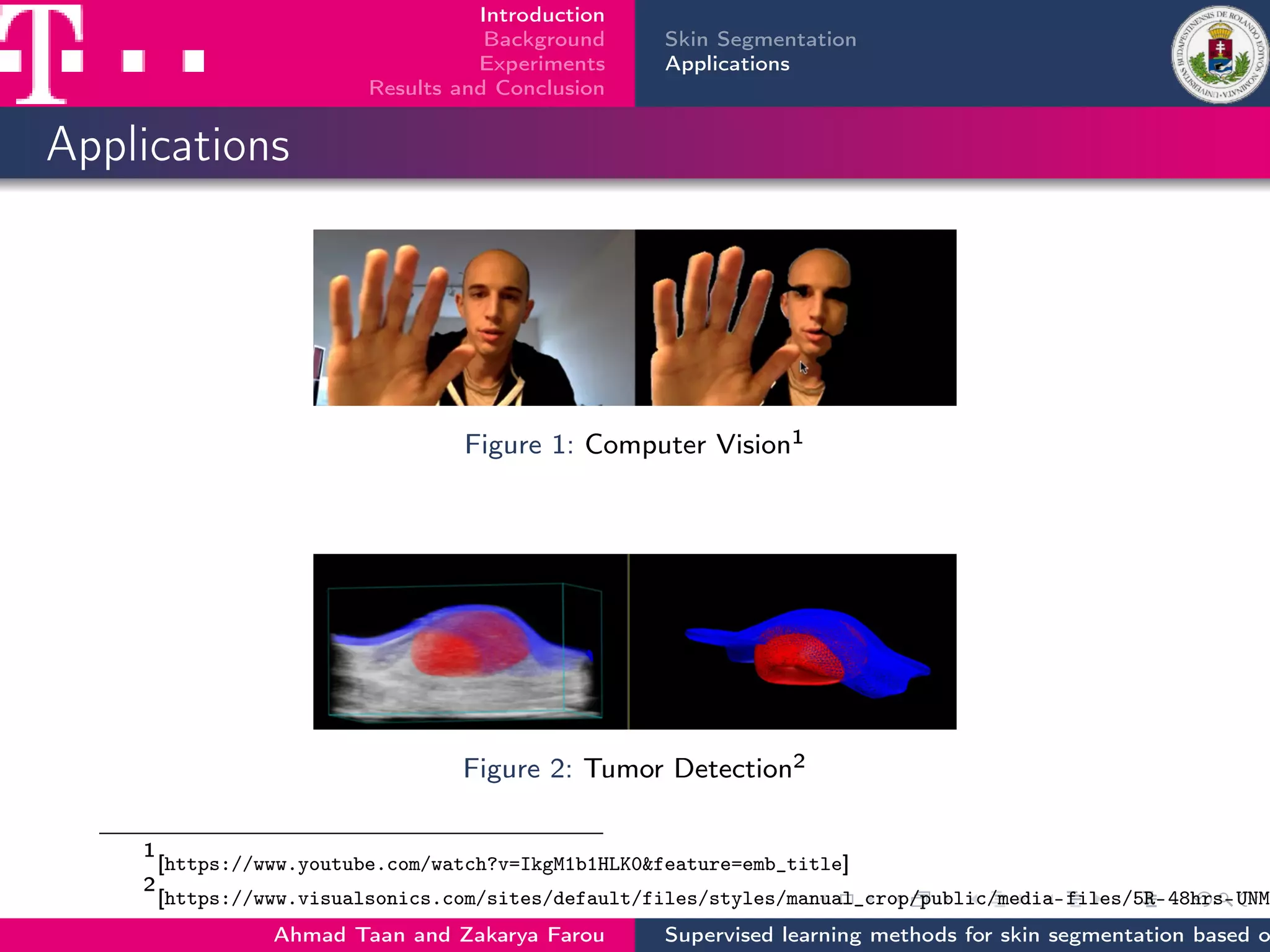 Supervised Learning Methods For Skin Segmentation Based On Color Pixel Classification Ppt