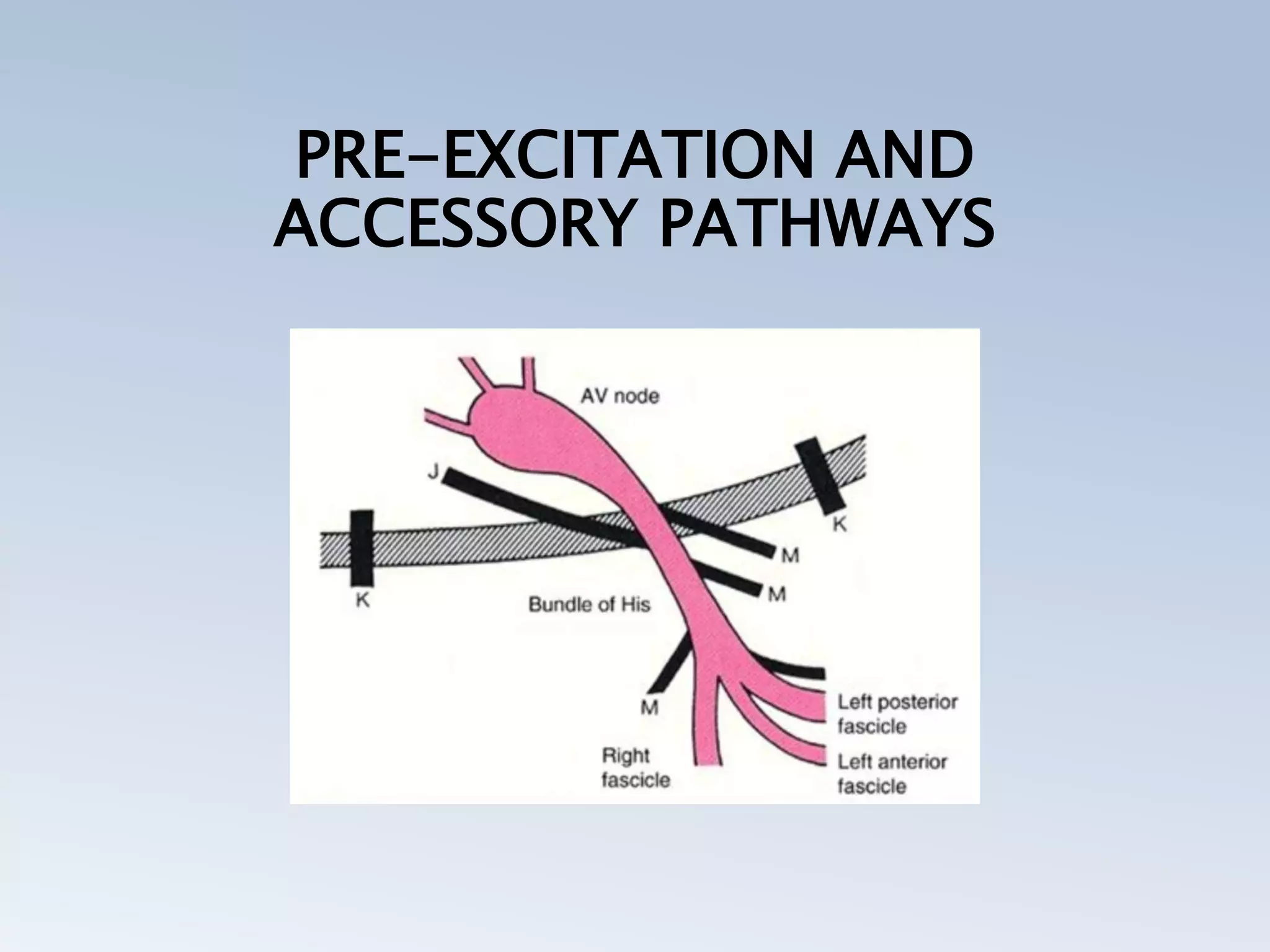 PRE EXCITATION SYNDROMES (THE WOLFF PARKINSON WHITE, LPL, MAHAIM) | PPTX