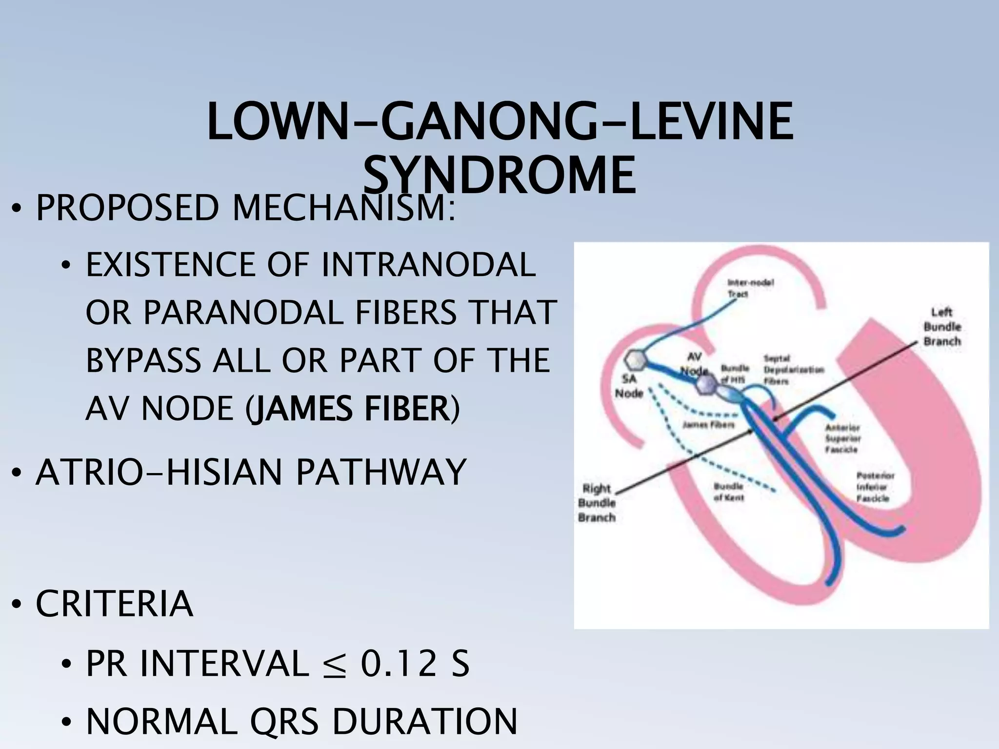 PRE EXCITATION SYNDROMES (THE WOLFF PARKINSON WHITE, LPL, MAHAIM) | PPTX