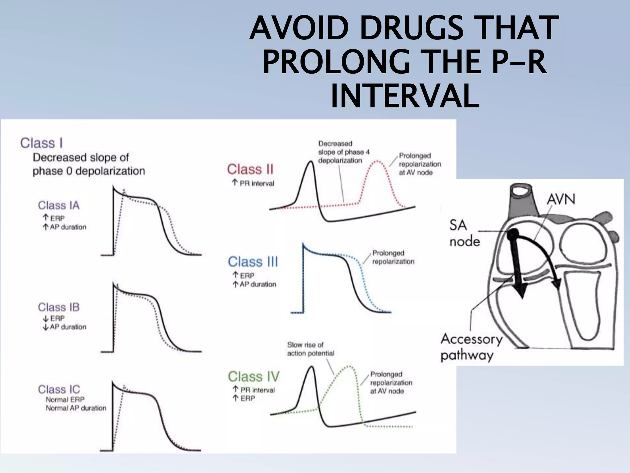 PRE EXCITATION SYNDROMES (THE WOLFF PARKINSON WHITE, LPL, MAHAIM) | PPTX