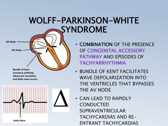 PRE EXCITATION SYNDROMES (THE WOLFF PARKINSON WHITE, LPL, MAHAIM ...