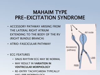 PRE EXCITATION SYNDROMES (THE WOLFF PARKINSON WHITE, LPL, MAHAIM) | PPT