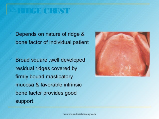 Support in complete dentures /certified fixed orthodontic courses by