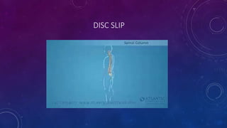 Support and movement ( videos ) | PPT