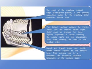 support for distal extension bases.ppt