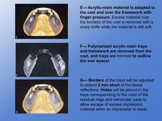 support for distal extension bases.ppt