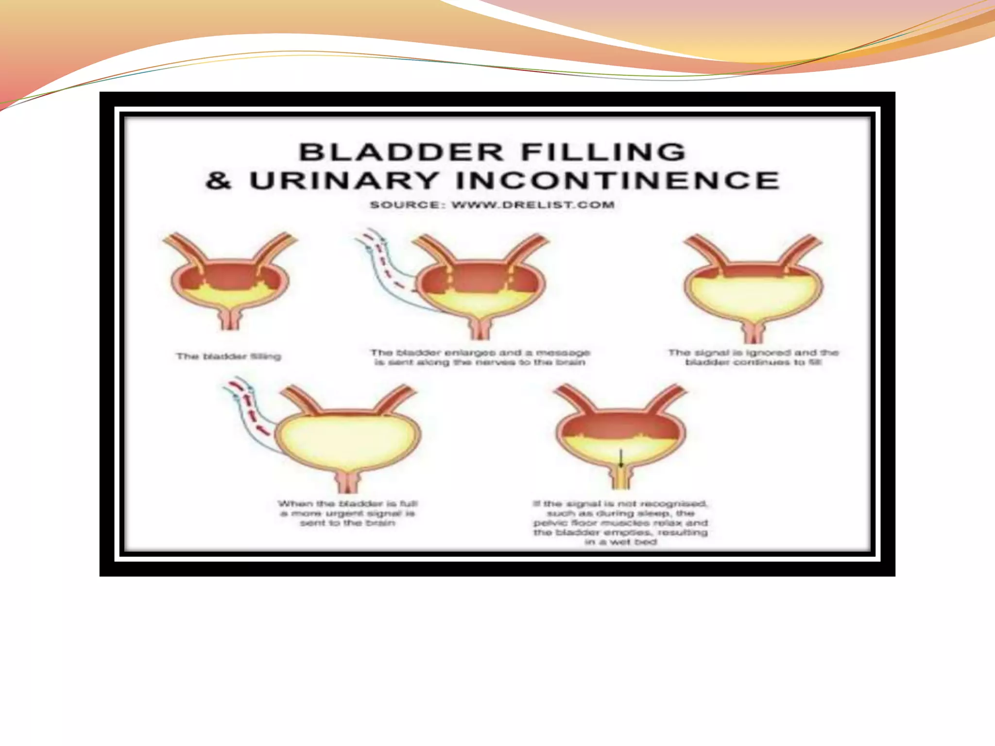 Suppositories & pessaries pharmaceutics-1 | PPTX