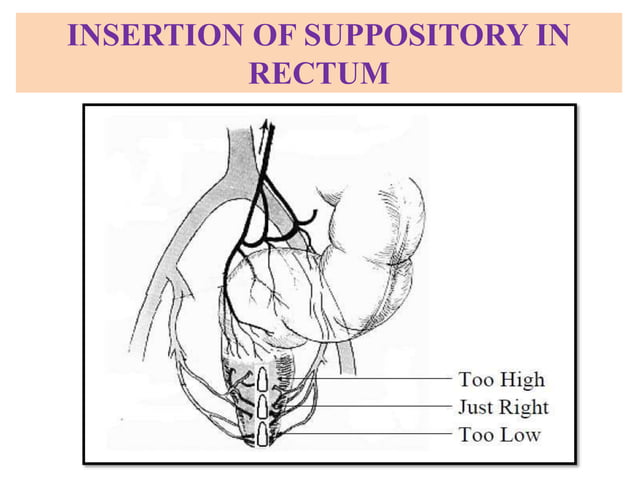 Suppository | PPTX | Medical Health