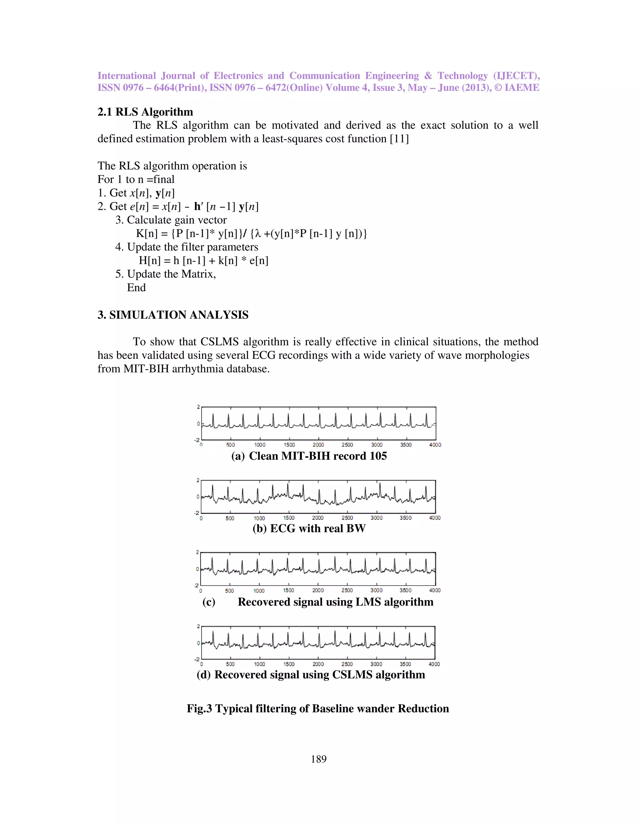 Suppression Of Power Line Interference Correction Of Baselinewanders