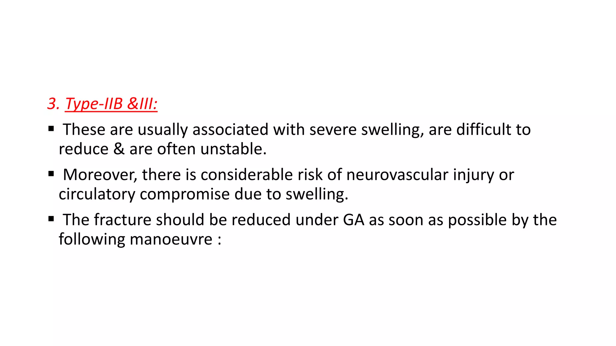 Supra condylar fracture | PPTX