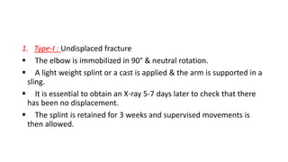 Supra condylar fracture | PPTX