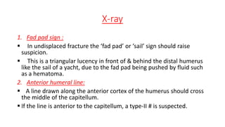 Supra condylar fracture | PPTX