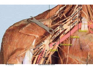 supra clavicular block.ppt