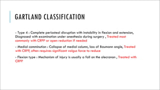 Supracondylar fracture | PDF