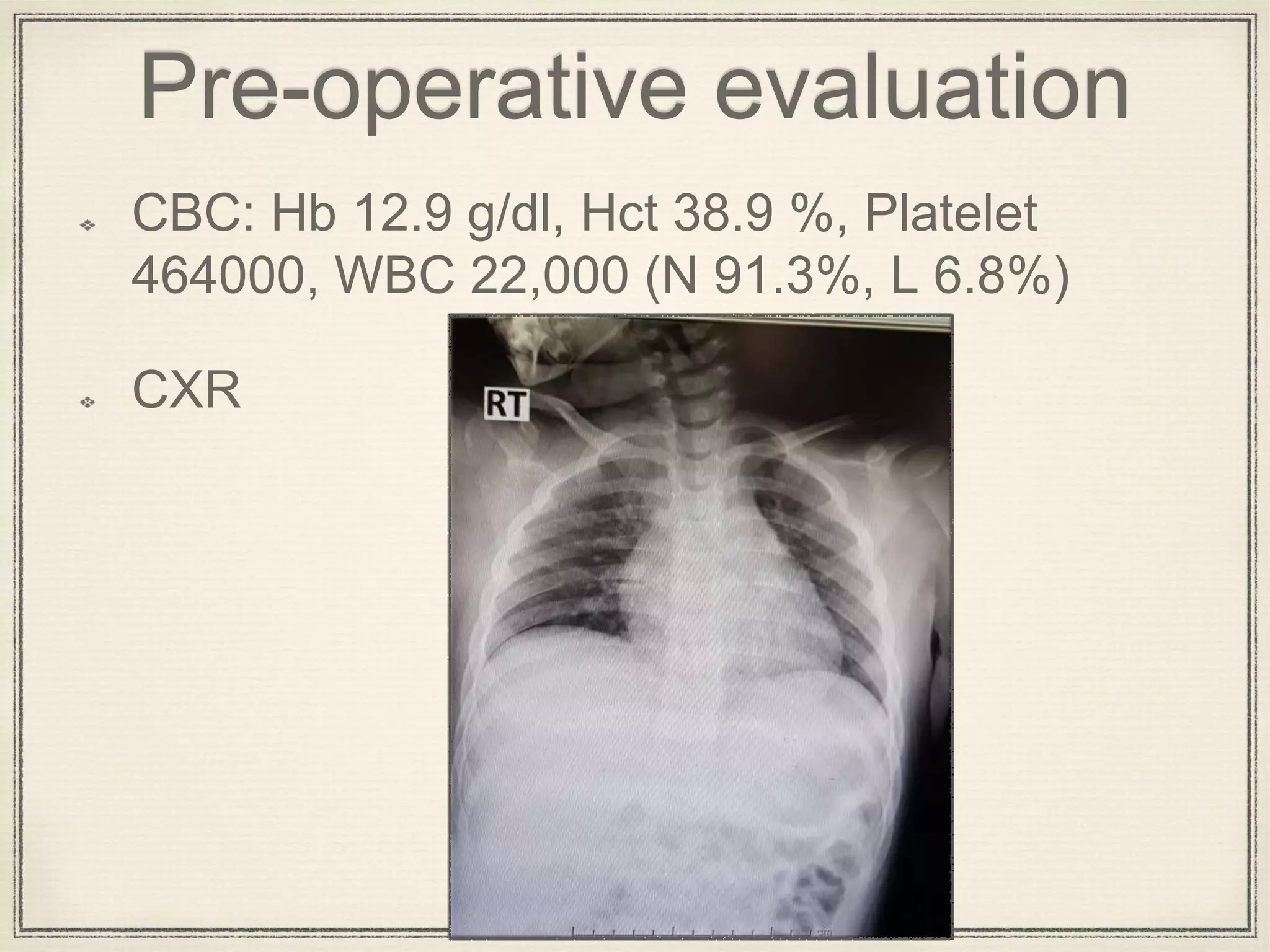 Supracondylar fracture | PPTX