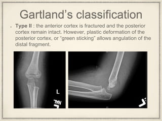 Supracondylar fracture | PPT