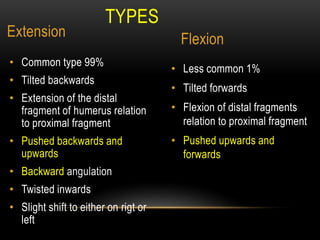 Supra condylar fracture.pptx