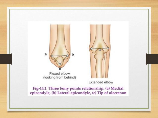 Supracondylar fracture- Dr Sundar Ortho.pptx | Death, Injury, or Military Conflict | Sensitive ...