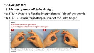 SUPRACONDYLAR FRACTURE - PAEDIATRIC.pptx