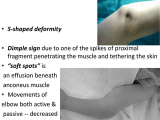 Supracondylar fracture of the humerus by phaneendra akana | PPTX