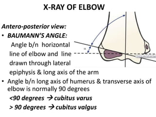Supracondylar fracture of the humerus by phaneendra akana | PPT