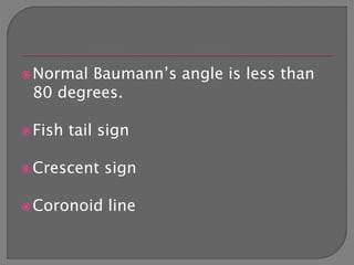 supracondylarfractureofthehumerus-180125165039.pdf